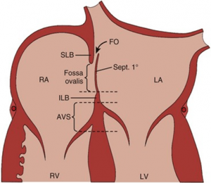 EL FORAMEN OVAL PERMEABLE. ¿QUE SABEMOS EN 2019? - Sociedad de ...