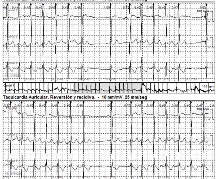 Resultado ECG - Sociedad de Cardiología de Rosario
